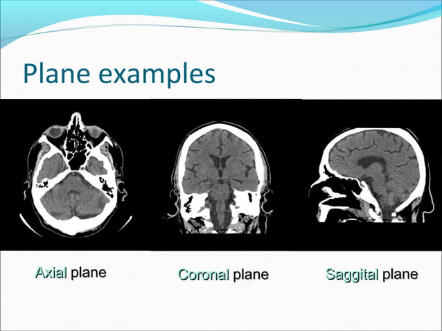 Approach to head ct | PPT