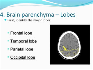 Approach to head ct | PPT