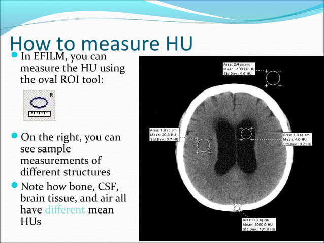 Approach to head ct | PPT