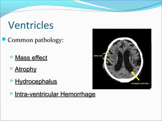 Approach to head ct | PPT