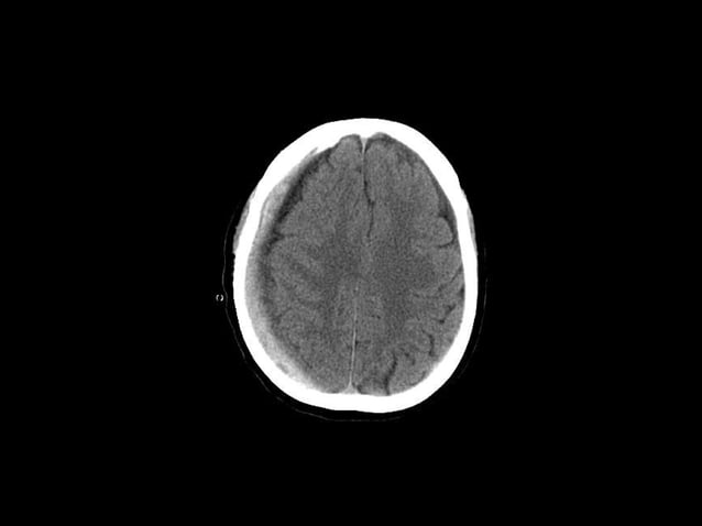 Approach to head ct
