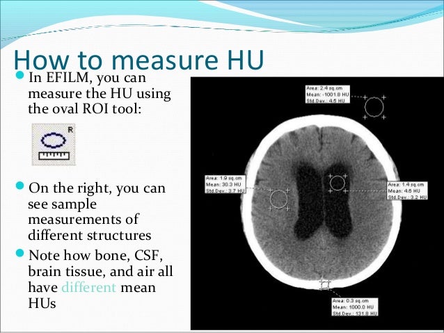 Approach to head ct