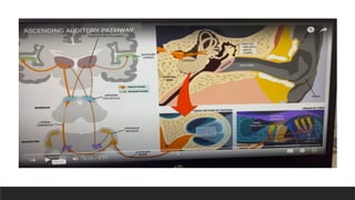 APPROACH TO HEARING LOSS AND HEARING AID.pptx