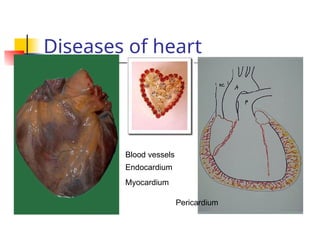 Approach. to. heart. | PPT