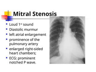 Approach. to. heart. | PPT