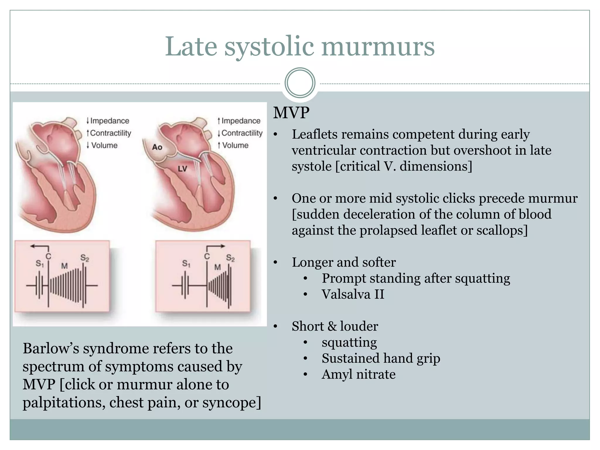 Approach to Heart Murmurs.pptx