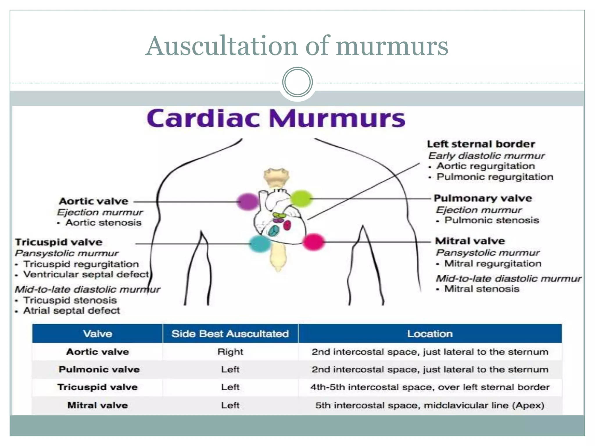 Approach to Heart Murmurs.pptx