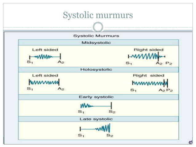 Approach to Heart Murmurs.pptx