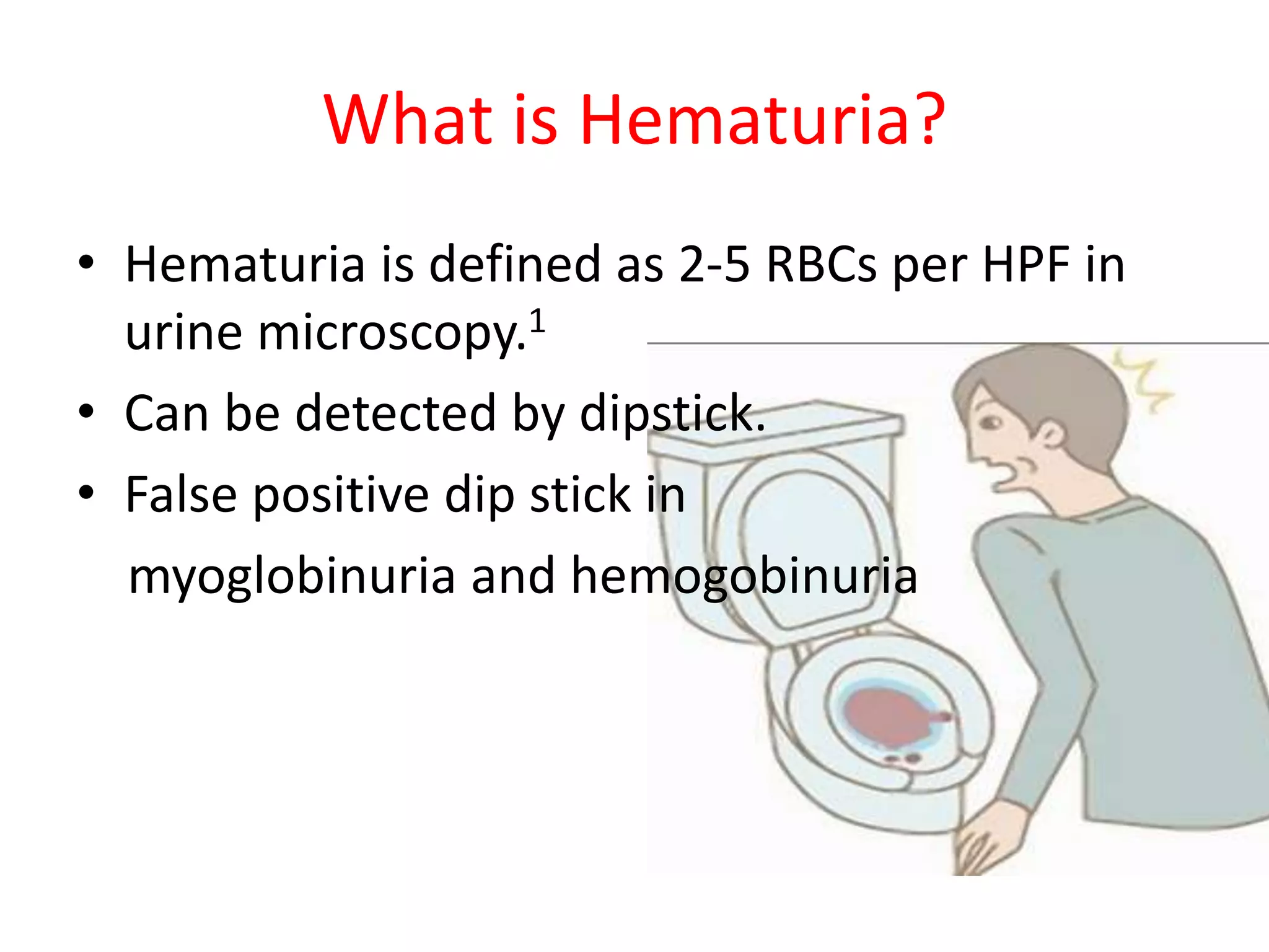 Approach to hematuria | PPTX