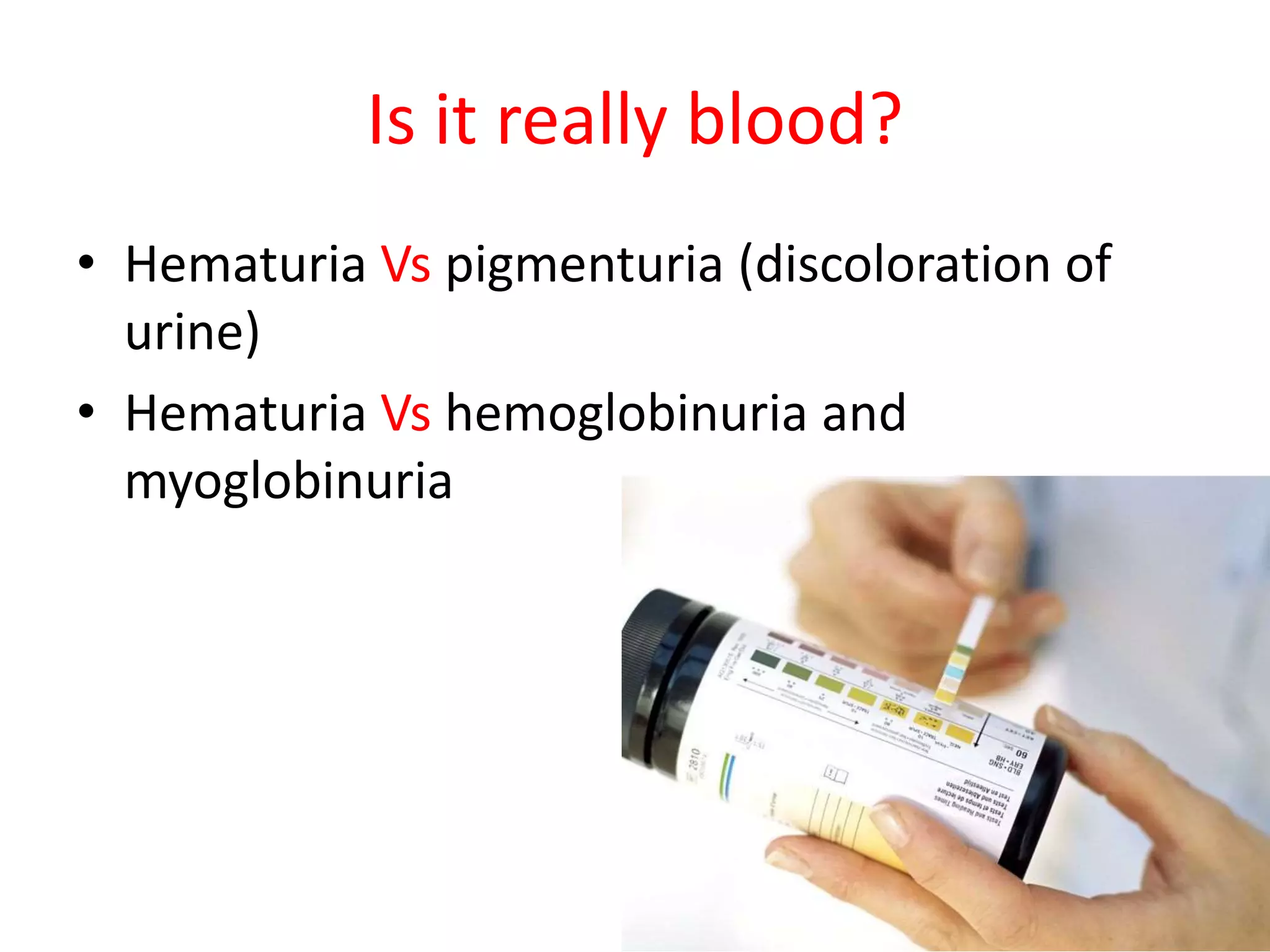 Approach to hematuria | PPTX