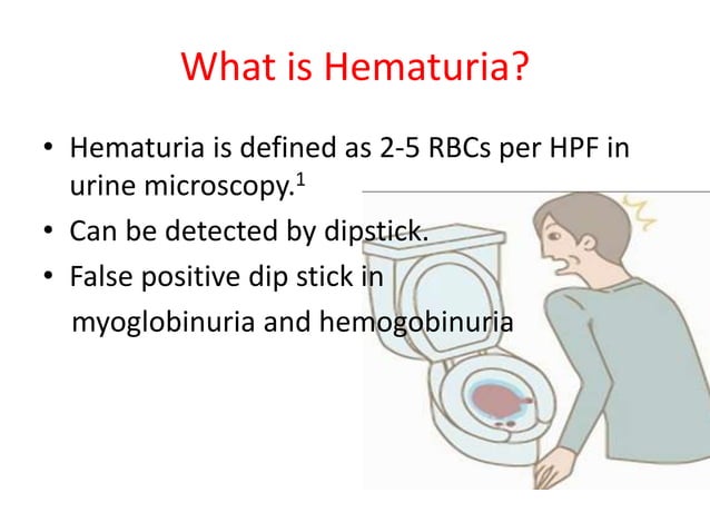approach to hematuria. Lower urinary tract symtoms | PPT