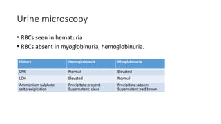 Approach to Hematuria in Children – Evaluation, Differentiation ...