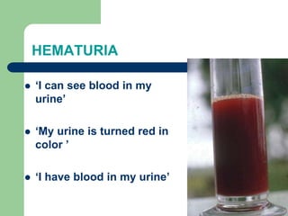 Approach to hematuria - general | PPT