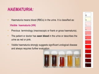 Approach to hematuriaAAAAAAAAAAAAAAA (2).pptx