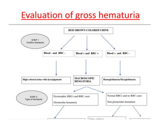 approach to hematuria in pediatrics.pptx