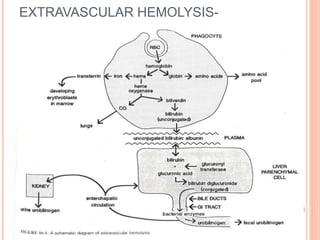 Diagnostic Approach to hemolytic anemia | PPTX