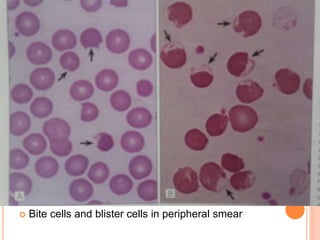Diagnostic Approach to hemolytic anemia | PPTX