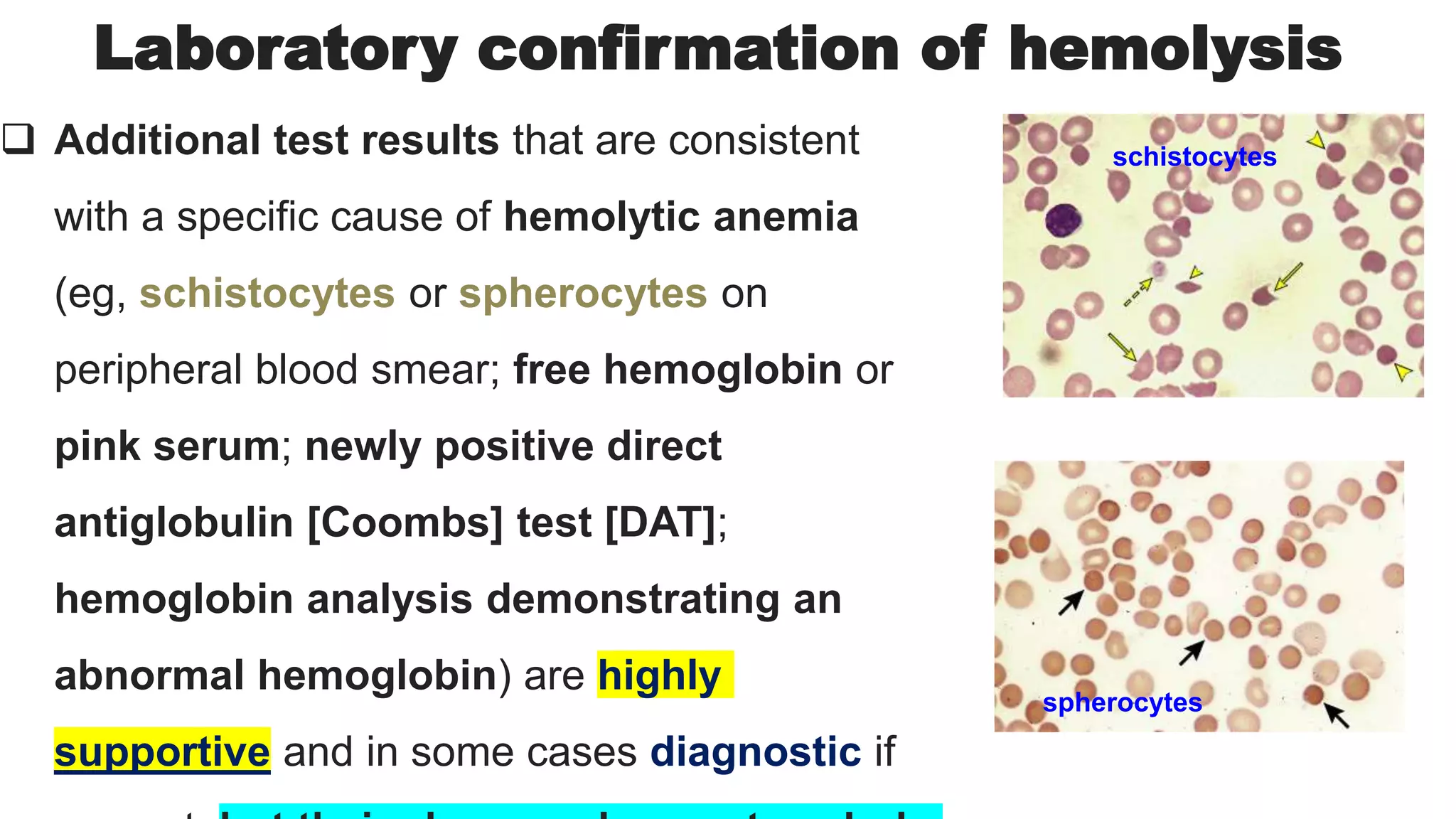 Diagnosis of hemolytic anemia | PPTX