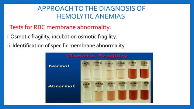 Approach to hemolytic anemias | PPTX | Blood Disorders | Diseases and ...