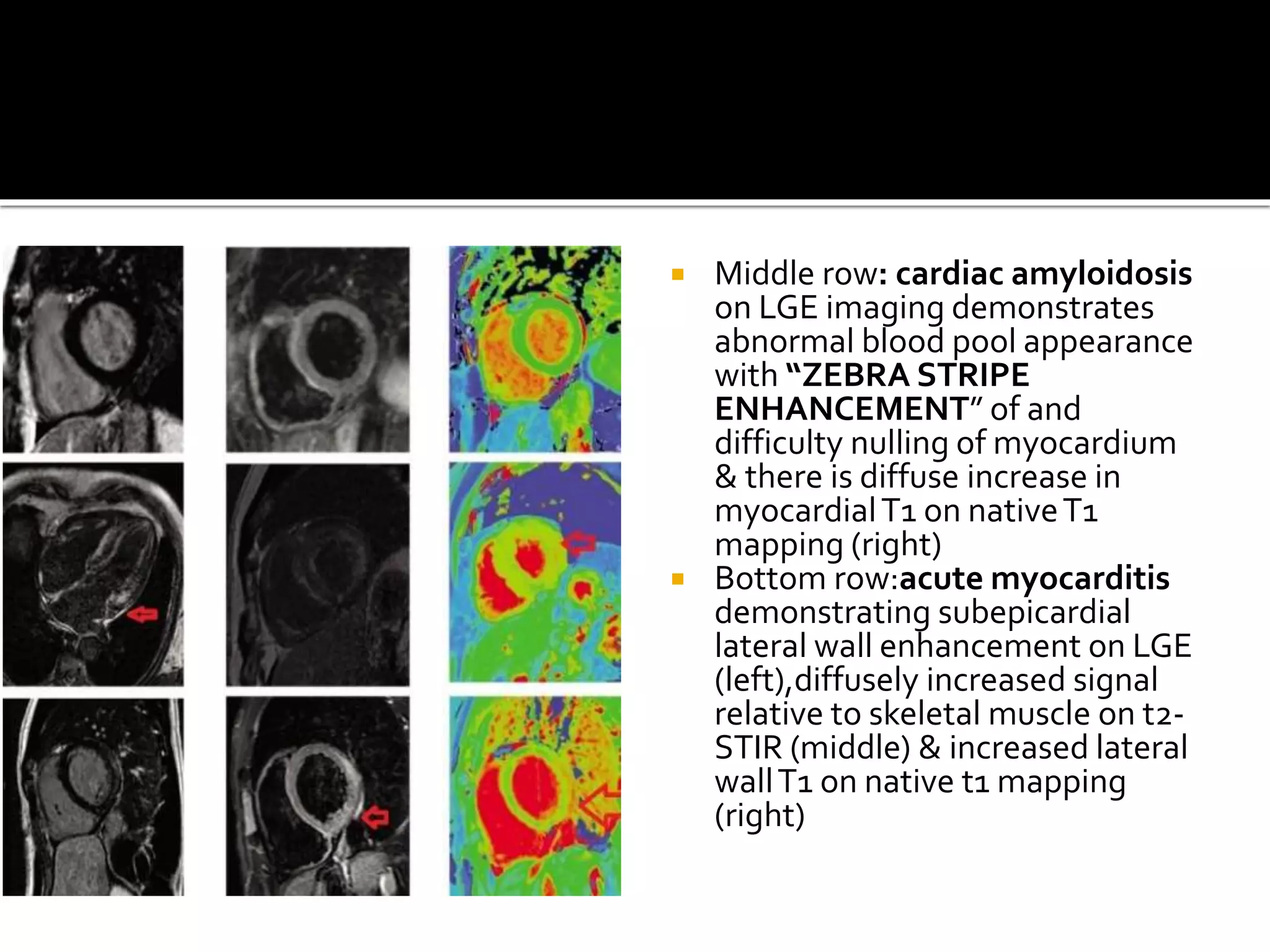 Approach to HFrEF | PPTX