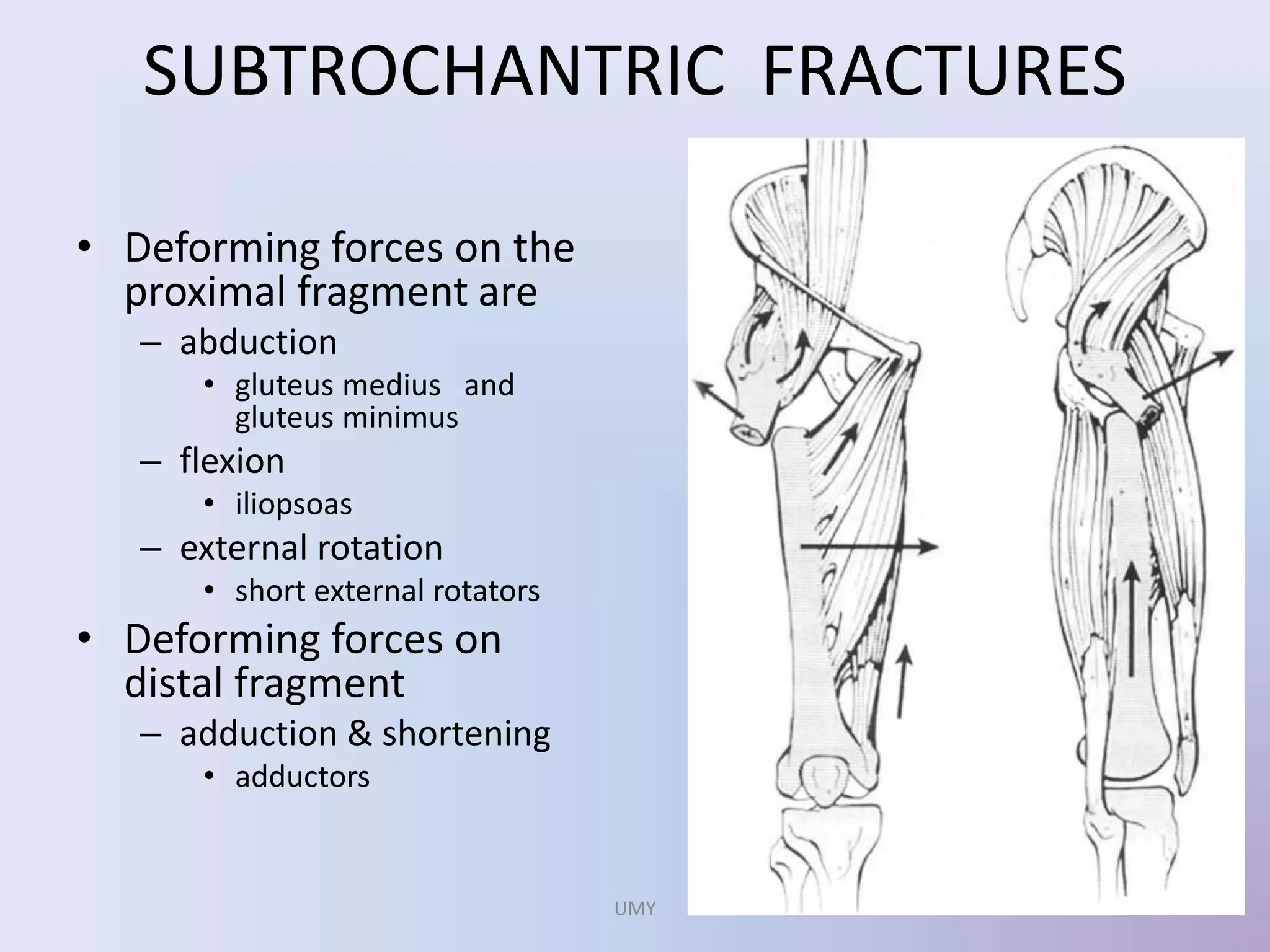 Approach to hip joint | PPTX