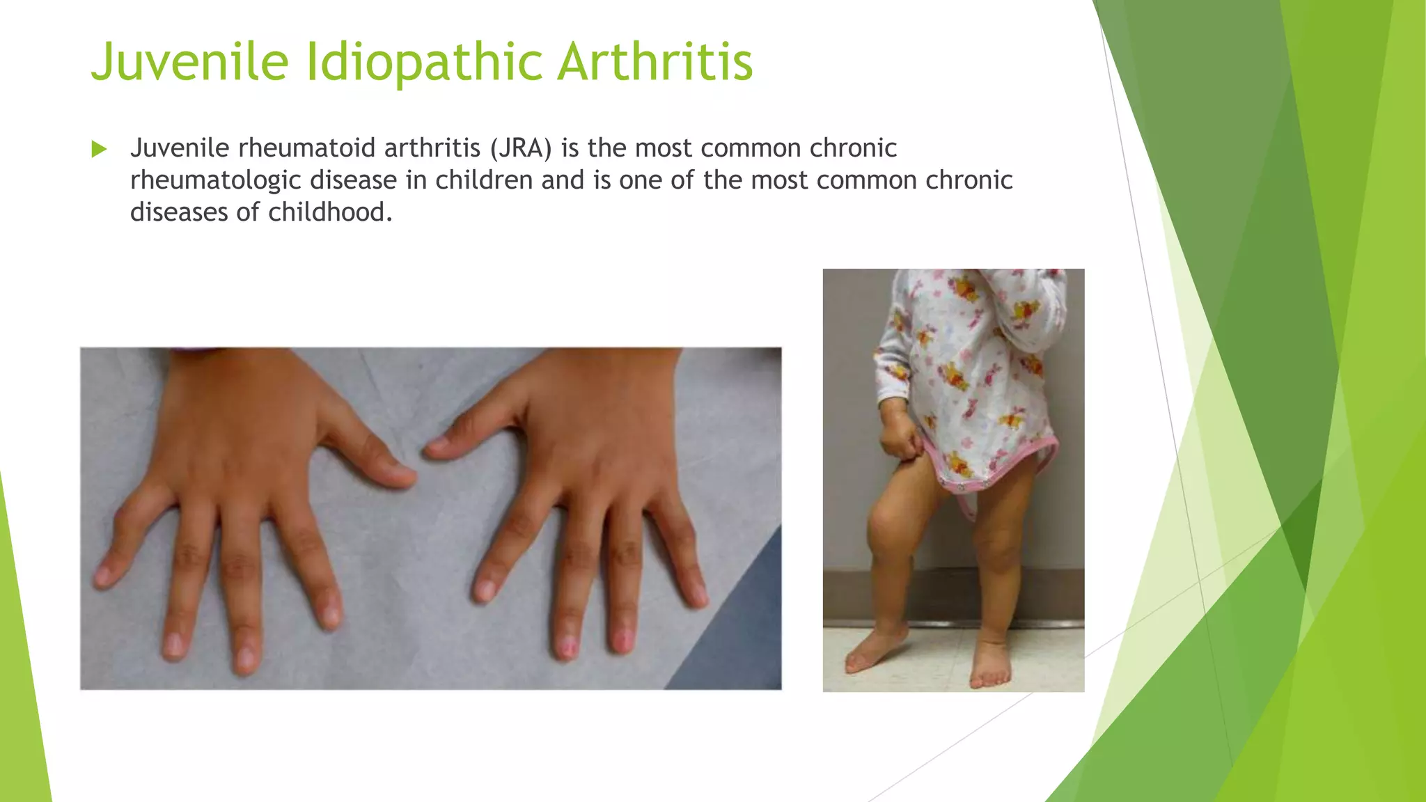 Approach to hip joint pain in childhood | PPTX