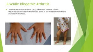 Approach to hip joint pain in childhood | PPTX
