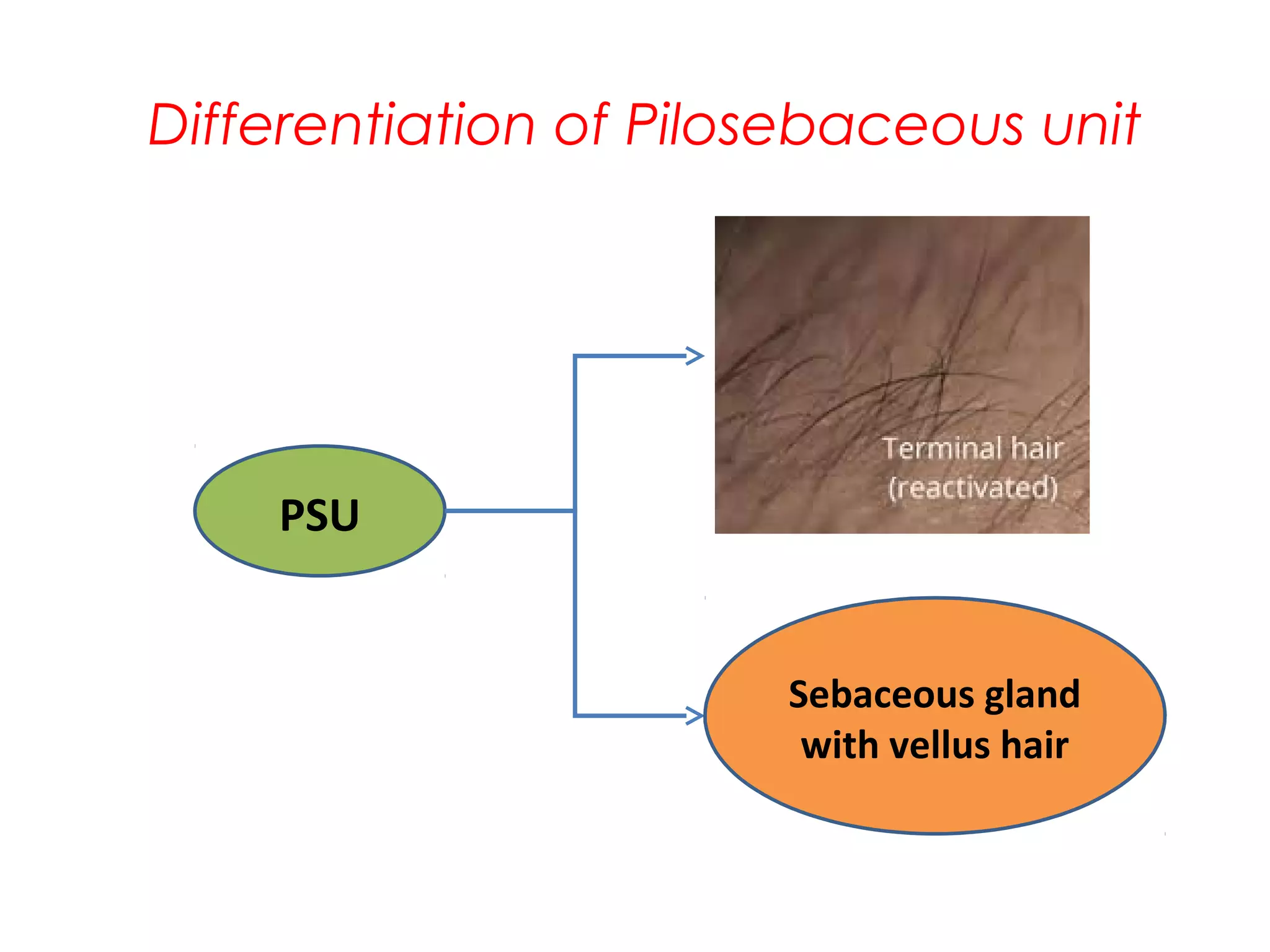 Approach to hirsutism | PPT