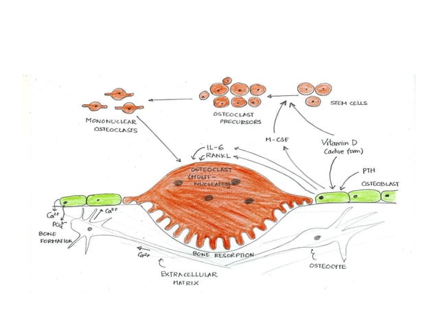 approach to hypocalcemia, causes, investigation, pathophysiology ...