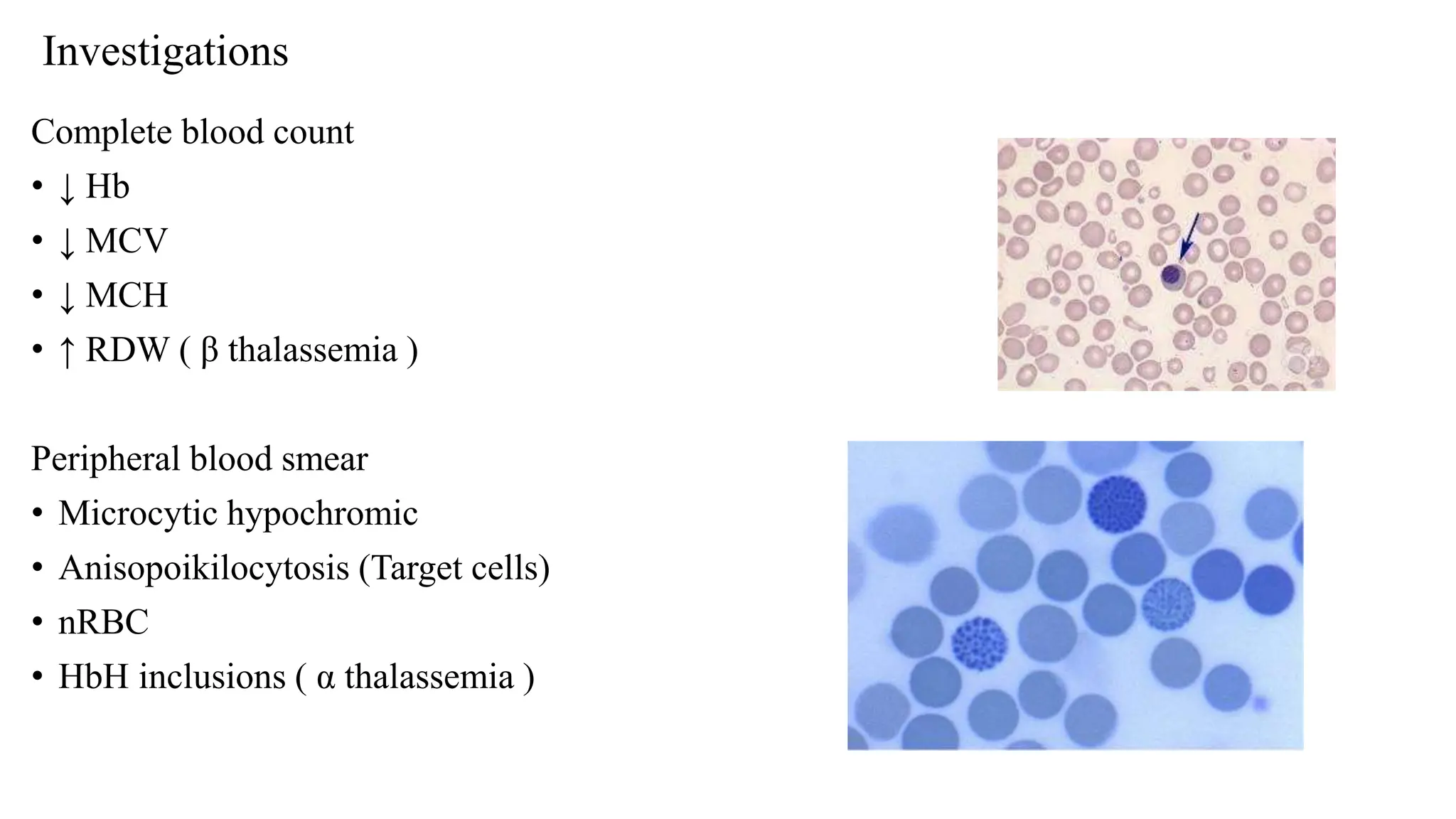 Approach to hypochromic microcytic anemias.pptx