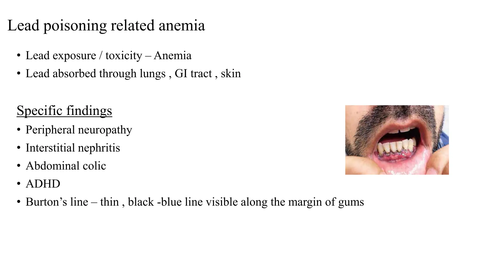 Approach to hypochromic microcytic anemias.pptx