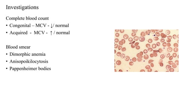 Approach to hypochromic microcytic anemias.pptx