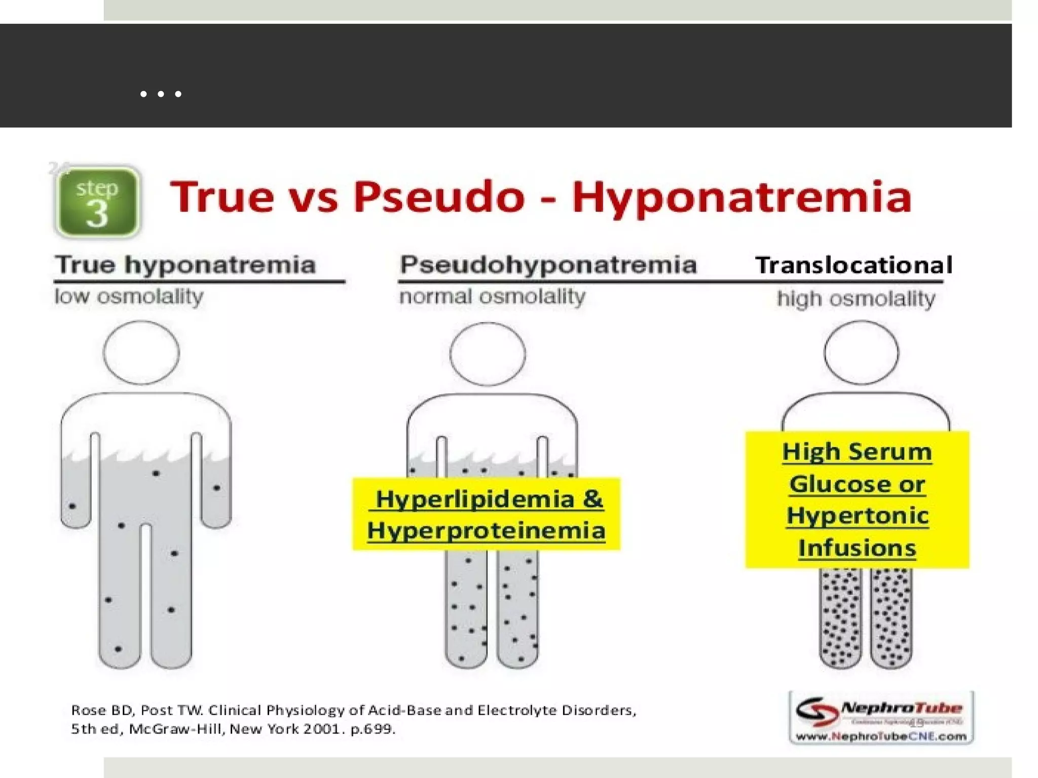 Approach to hyponatremia | PPT