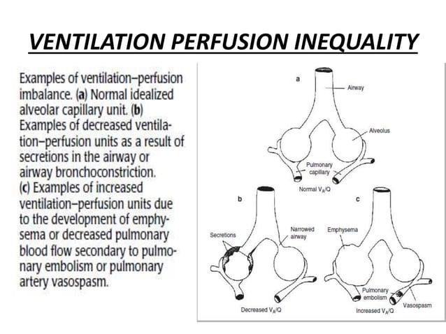 Approach to hypoxemia | PPT