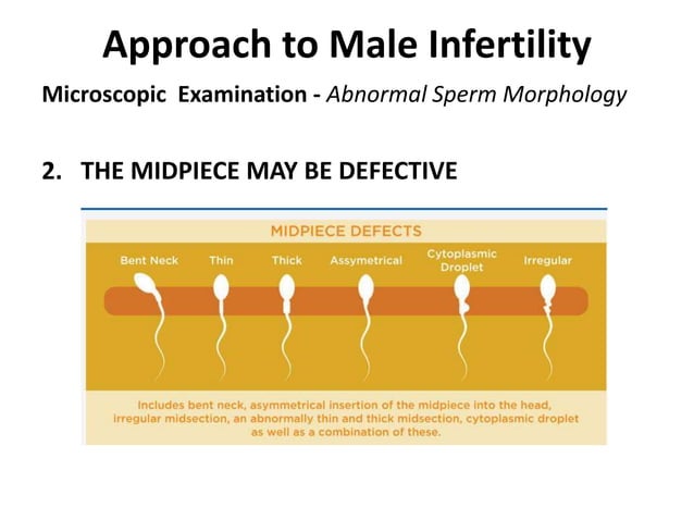 Approach to infertility | PPTX