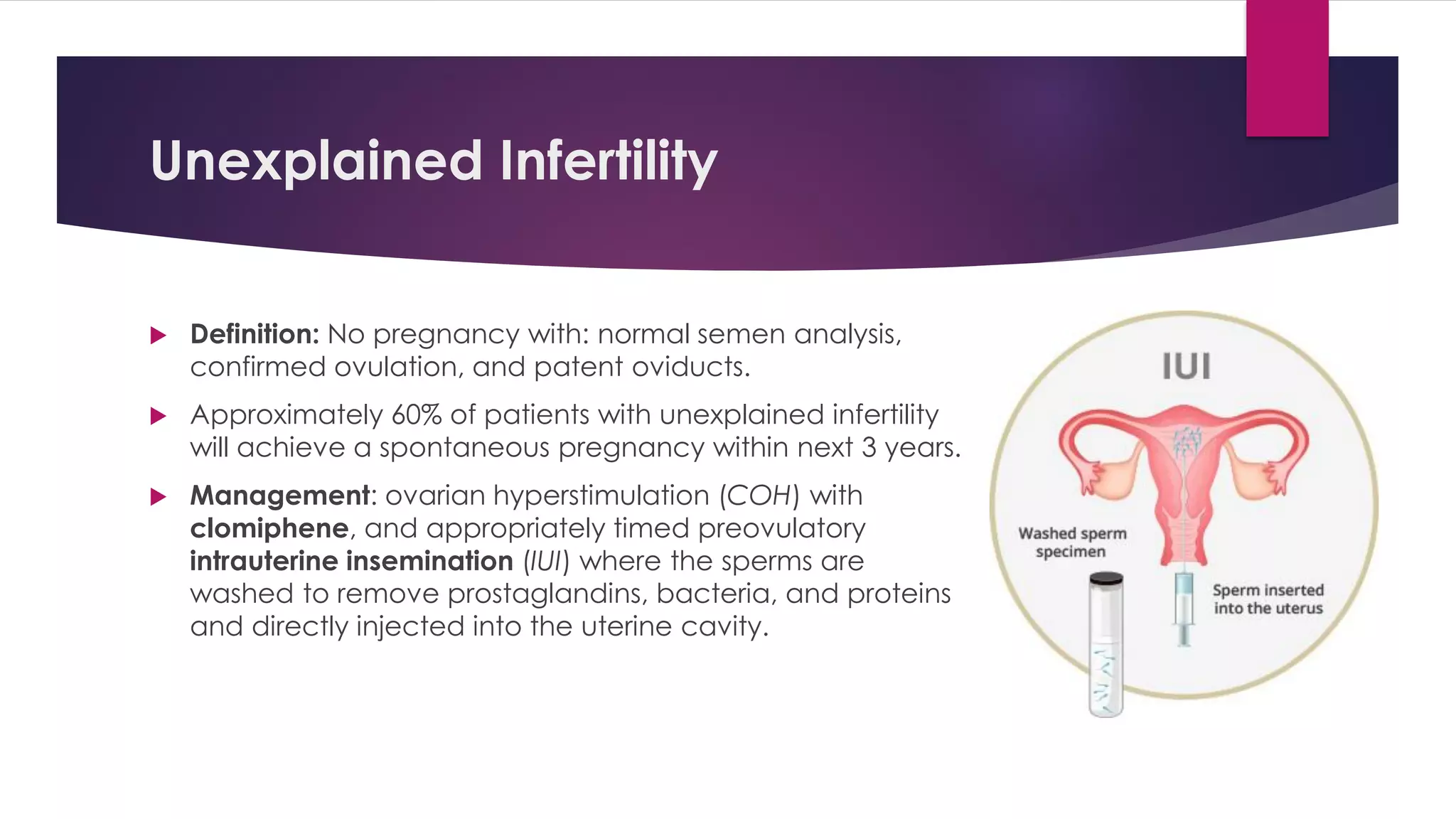 Approach to Infertility By Essam Sidqi | PPT