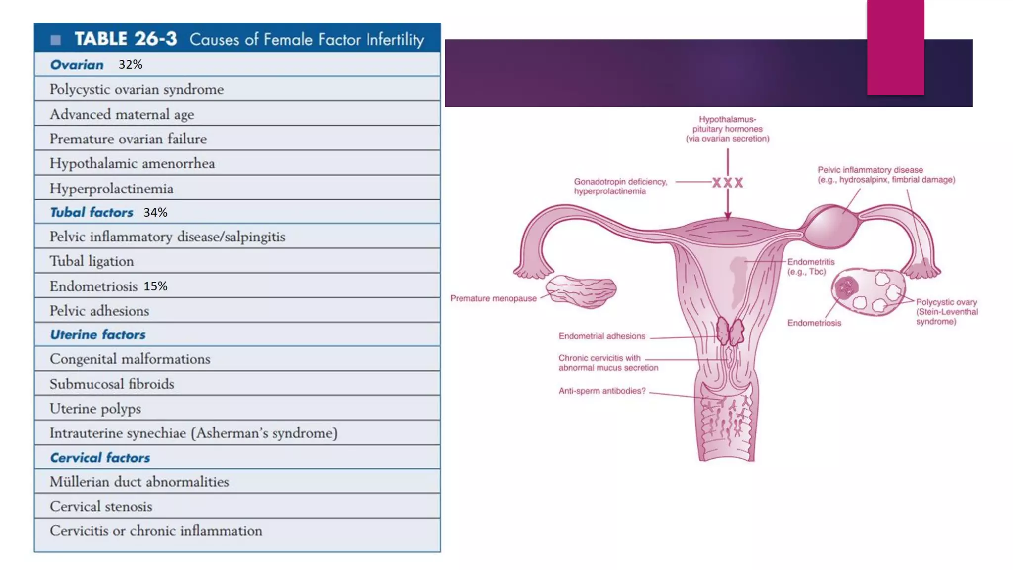 Approach to Infertility By Essam Sidqi | PPT