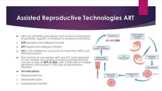 Approach to Infertility By Essam Sidqi | PPT
