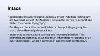 Approach to Irregular Astigmatism ophthalmology | PPTX