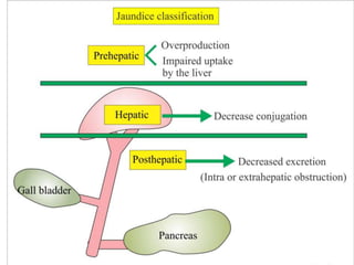 Approach to jaundice | PPTX