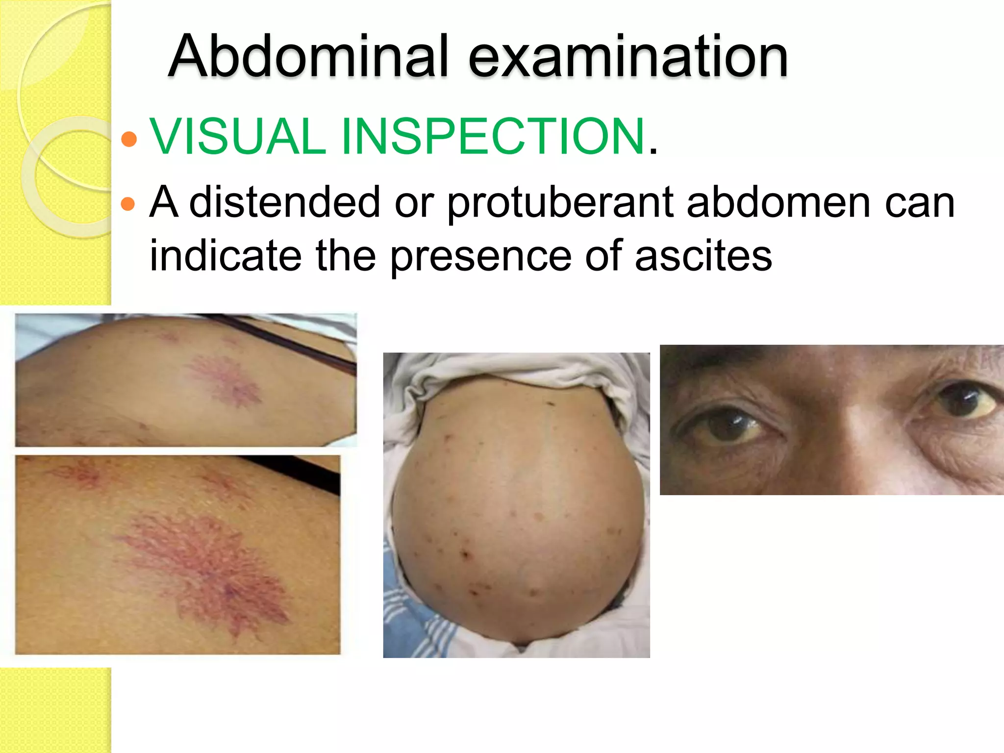 APPROACH TO JAUNDICE IN EMERGENCY MEDICINE New.pptx GEETHA.pptx