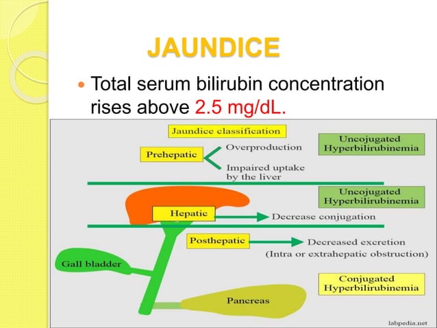 APPROACH TO JAUNDICE IN EMERGENCY MEDICINE New.pptx GEETHA.pptx