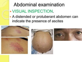 APPROACH TO JAUNDICE IN EMERGENCY MEDICINE New.pptx GEETHA.pptx