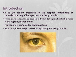 Yellow Eyes Jaundice Adults