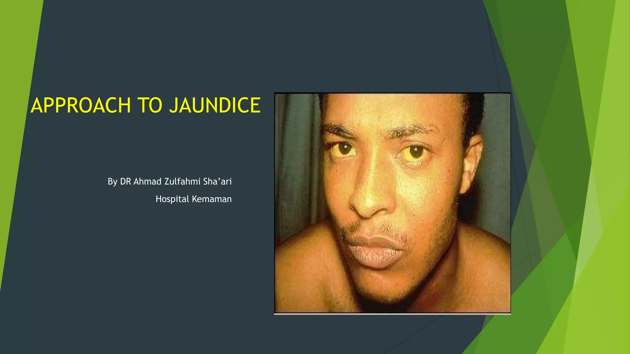 Approach to jaundice | PPTX