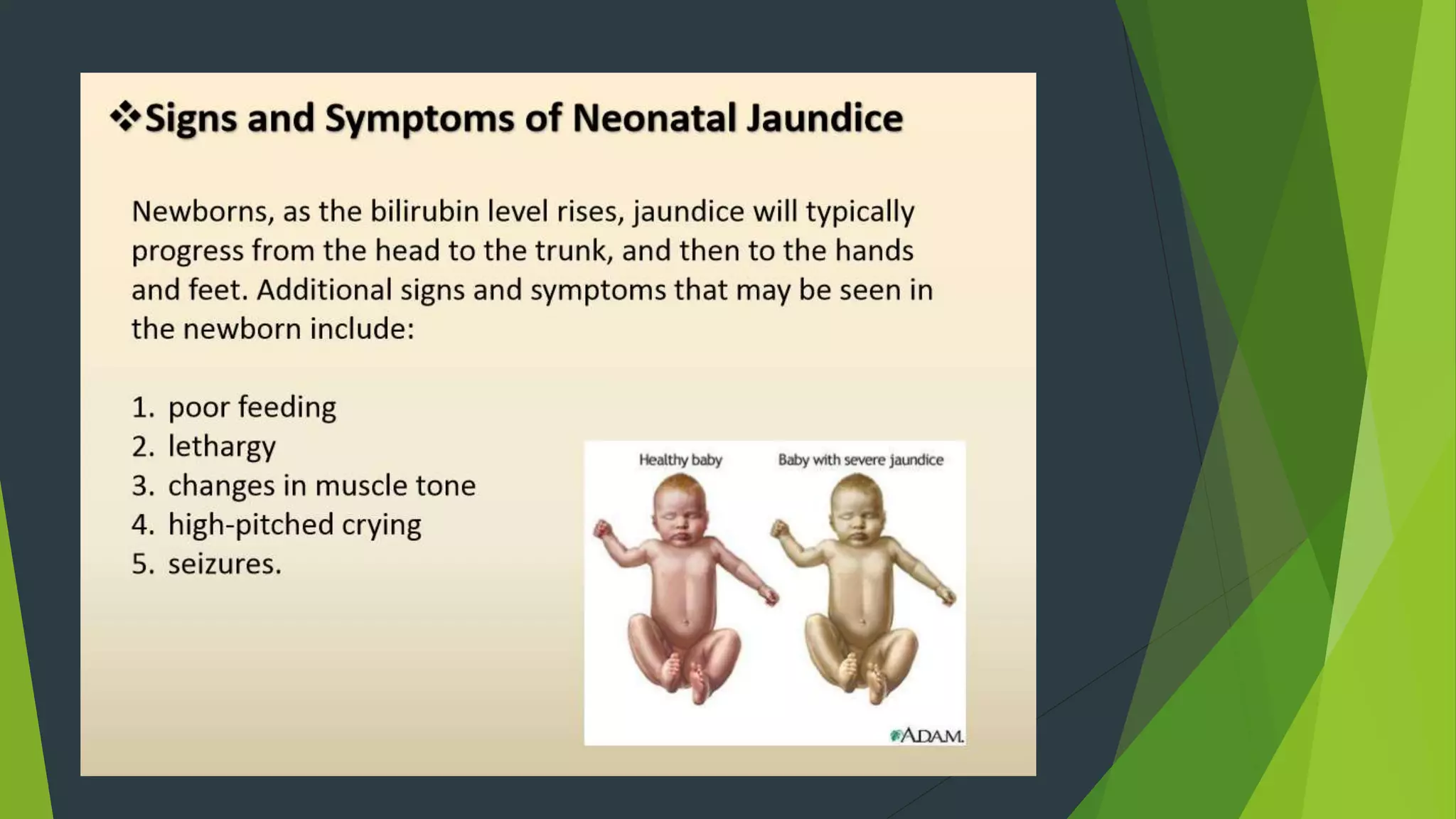 Approach to jaundice | PPTX