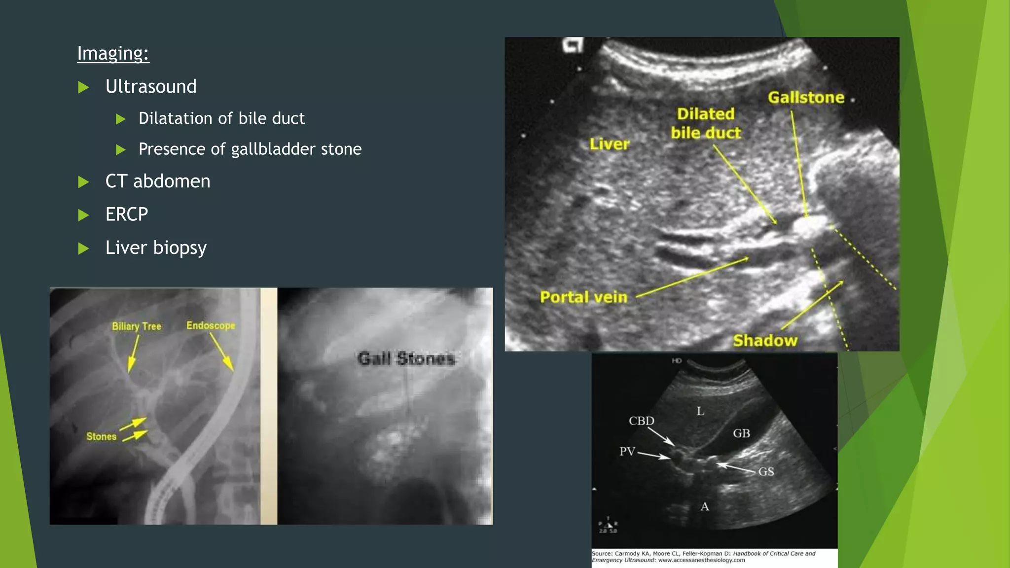 Approach to jaundice | PPTX
