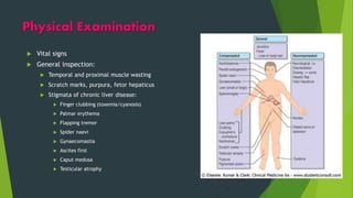 Approach to jaundice | PPTX