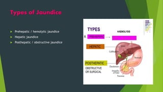 Approach to jaundice | PPTX