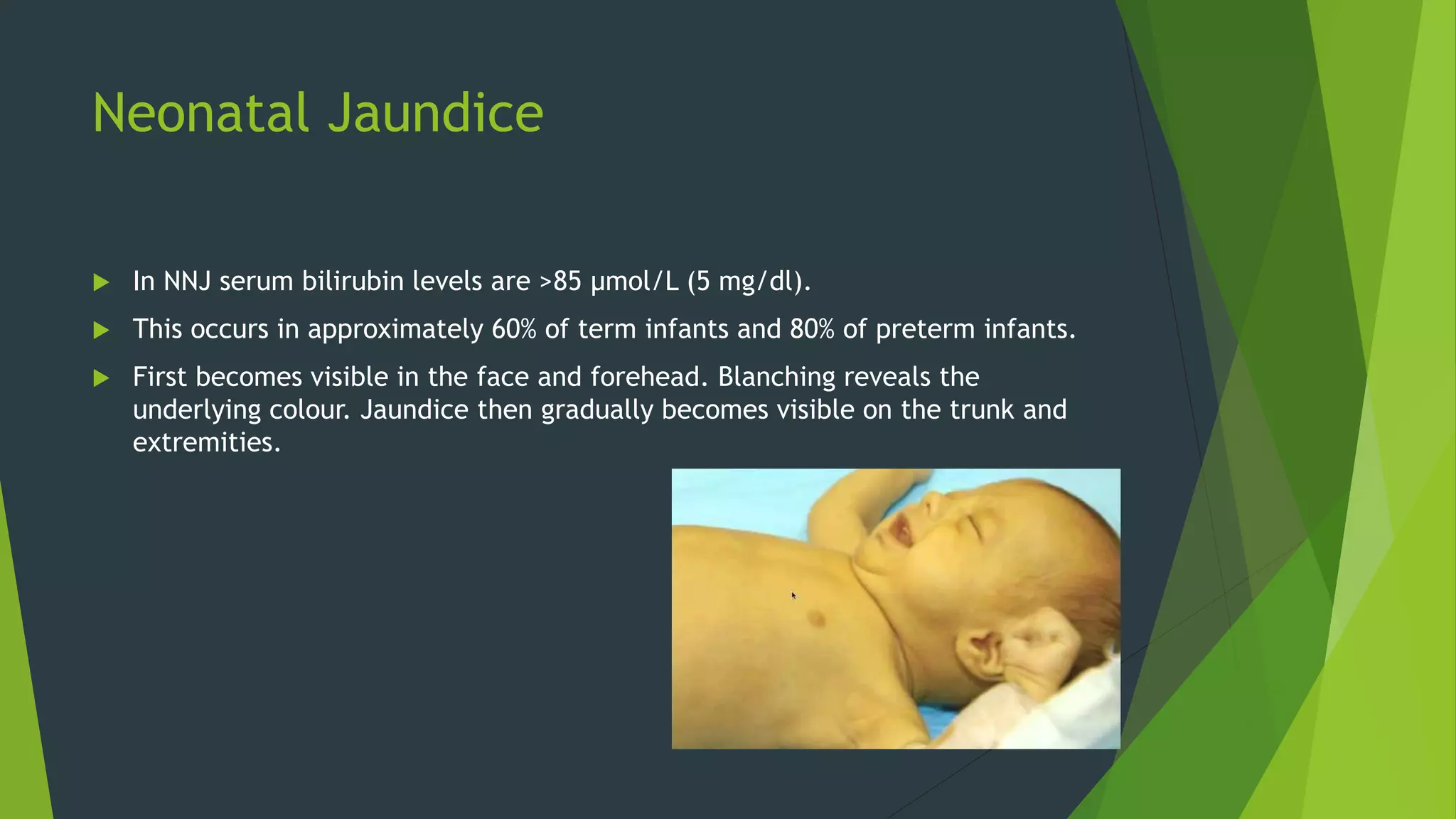 Approach to jaundice | PPTX